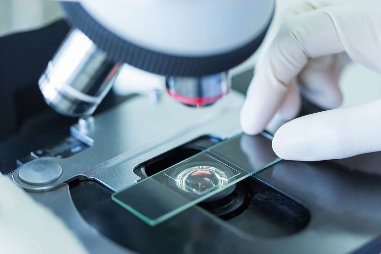 ¿Qué es el cáncer cervicouterino? Tratamiento del Virus del Papiloma ...